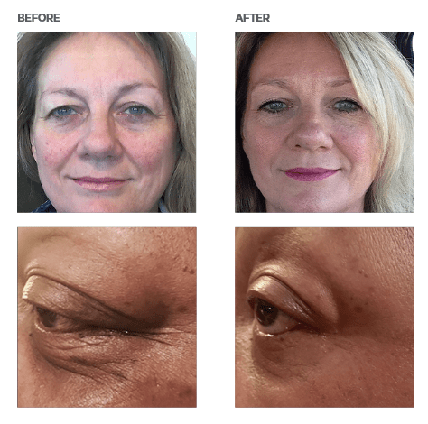 Modere Liquid Biocell Life Review - Biocell Guide