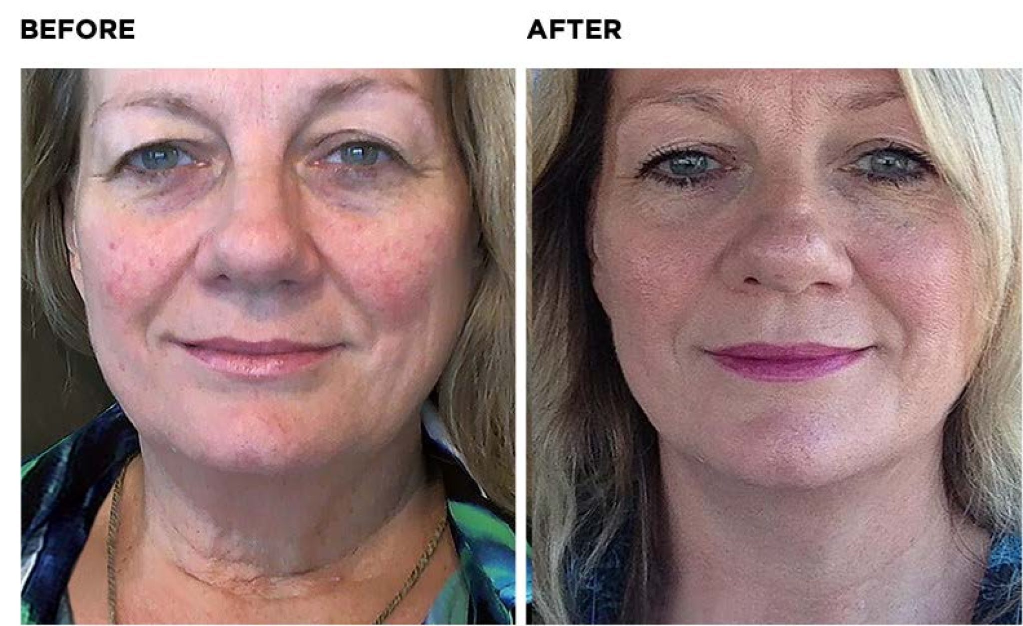 What is Biocell Collagen - Quick Review - Biocell Guide